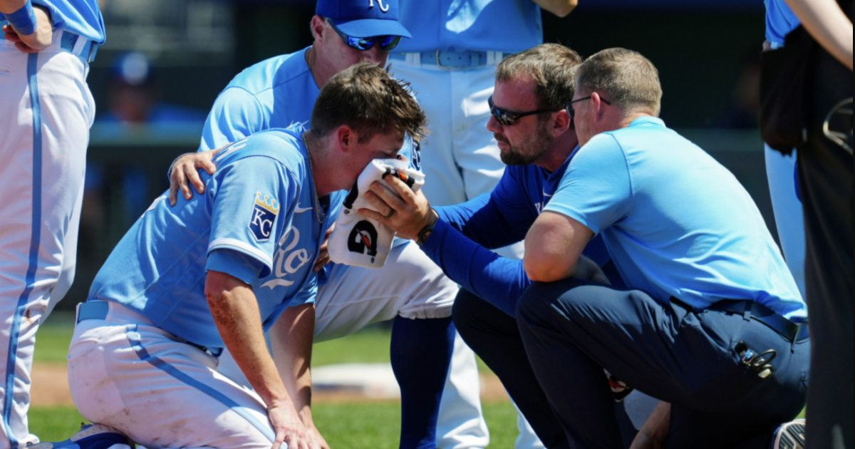 Royals Pitcher Takes Line Drive to the Face